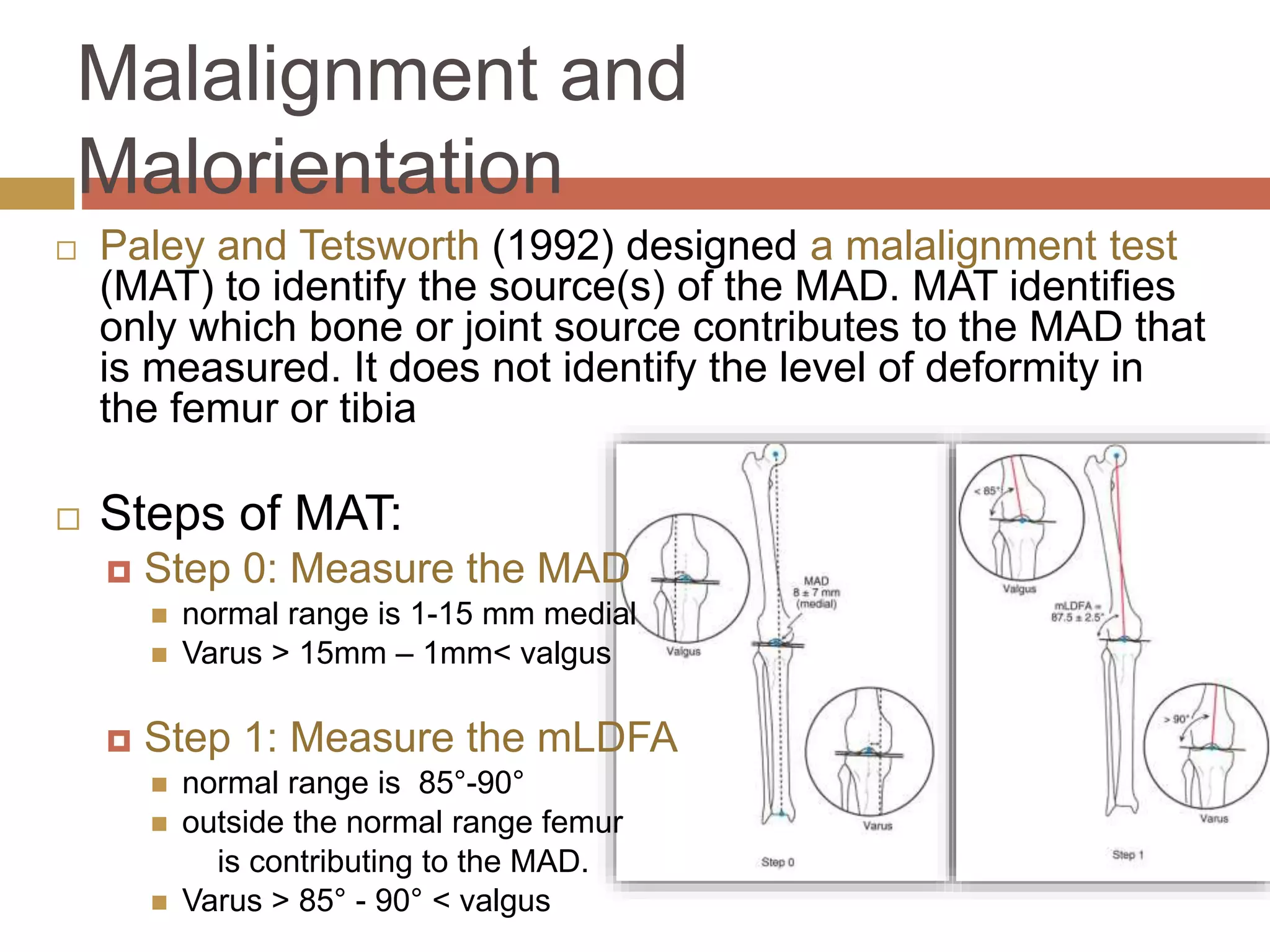 Principles of deformity correction | PPTX