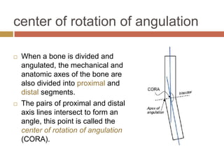 Principles of deformity correction | PPTX