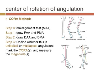 Principles of deformity correction | PPTX