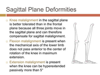 Principles of deformity correction | PPTX