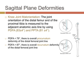 Principles of deformity correction | PPTX