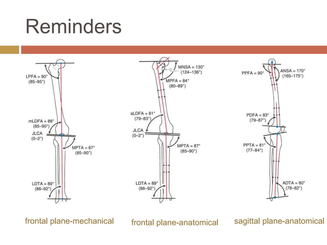 Principles of deformity correction | PPTX | Death, Injury, or Military ...