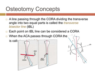 Principles of deformity correction | PPTX