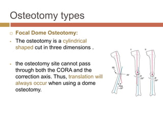 Principles of deformity correction | PPTX