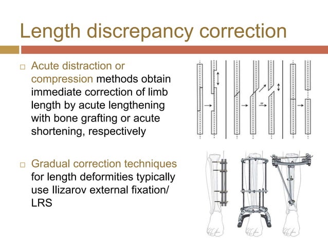 Principles of deformity correction | PPTX | Death, Injury, or Military ...
