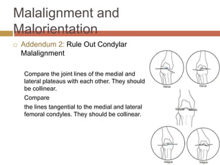Principles of deformity correction | PPTX