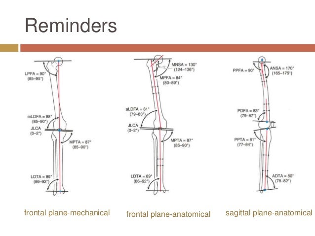 Principles of deformity correction