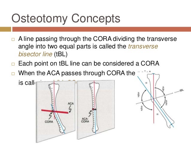 Principles of deformity correction