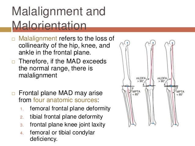 Principles of deformity correction