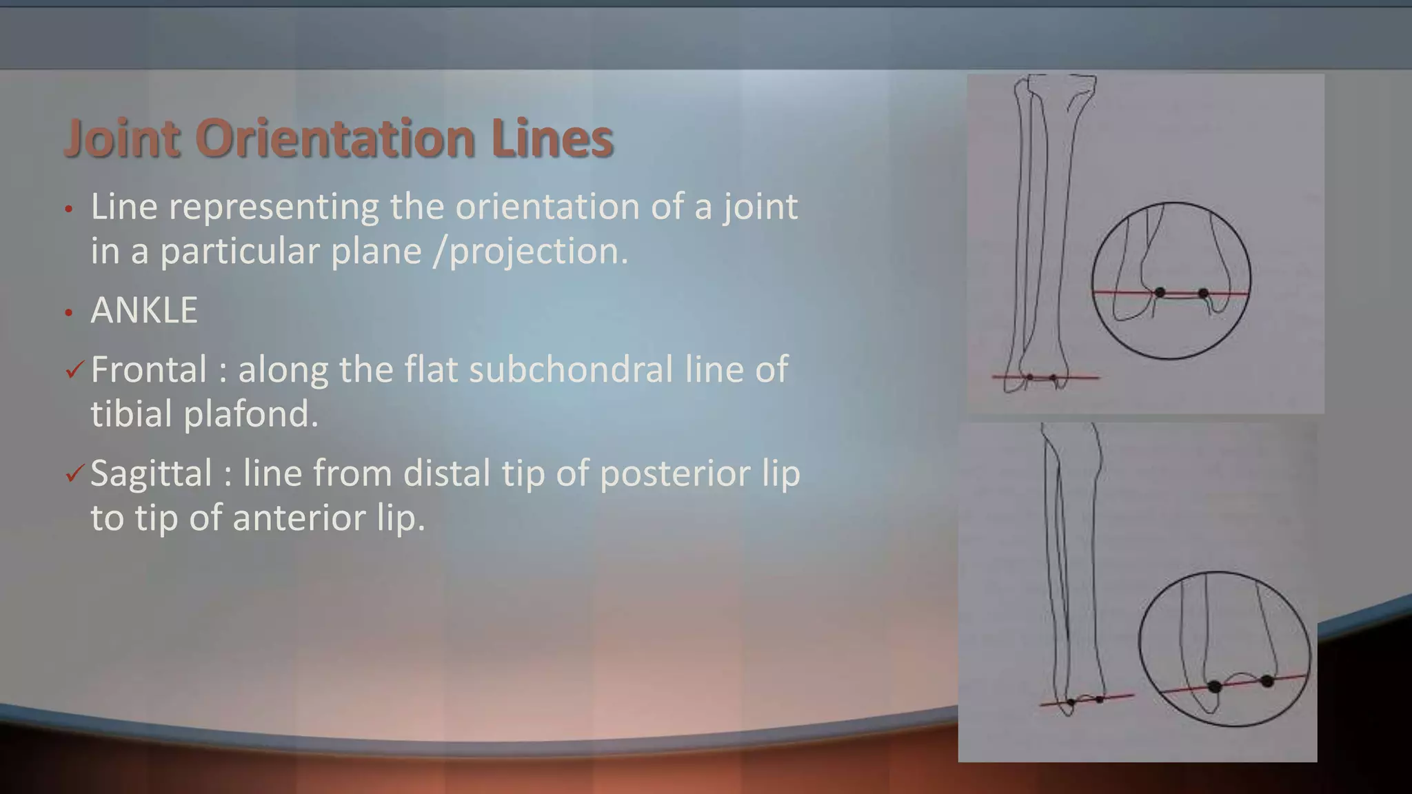 Principles of deformity correction | PPTX