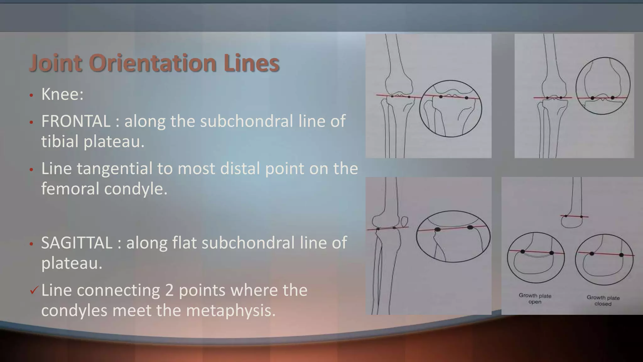 Principles of deformity correction | PPTX