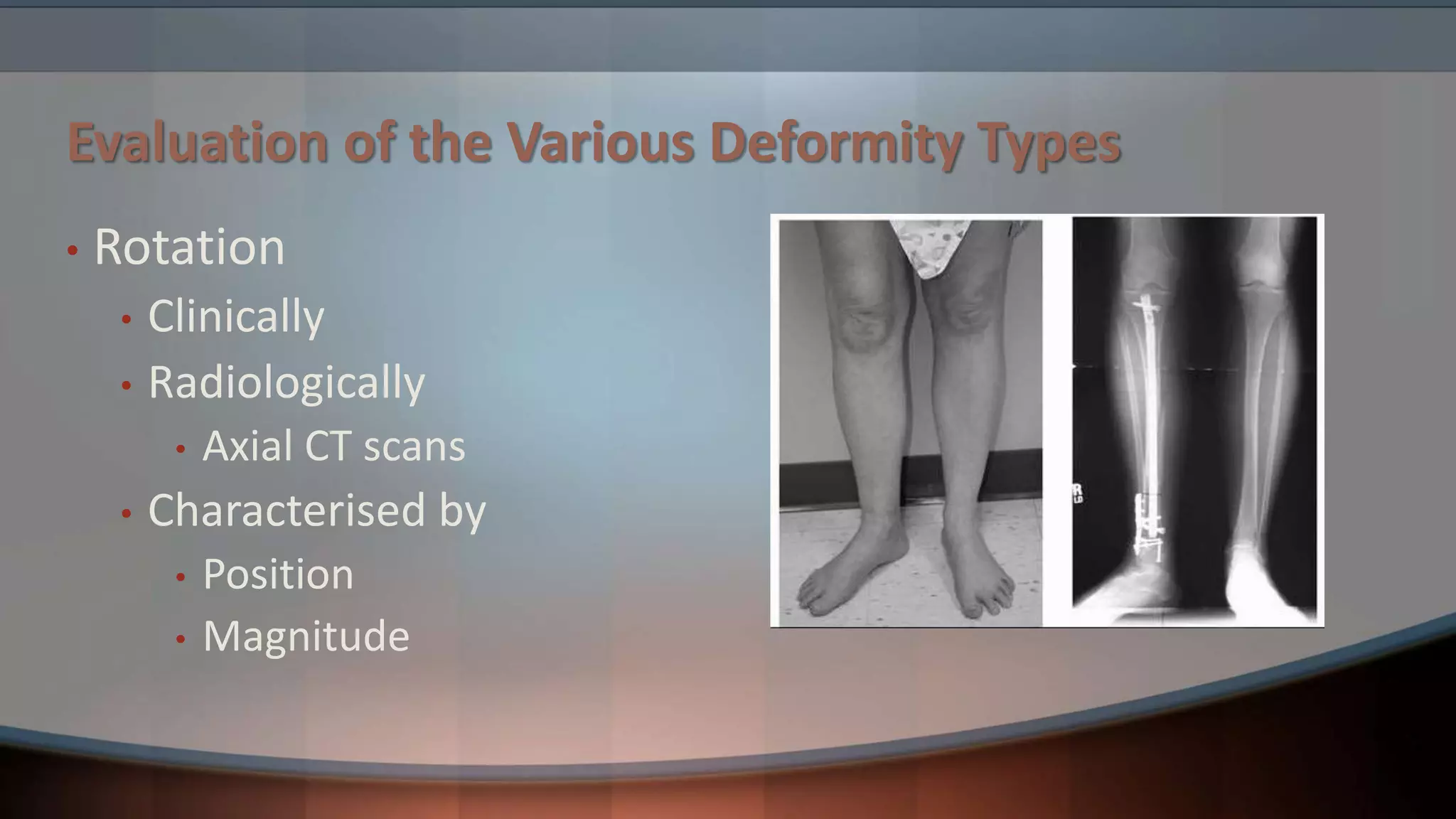 Principles of deformity correction | PPTX