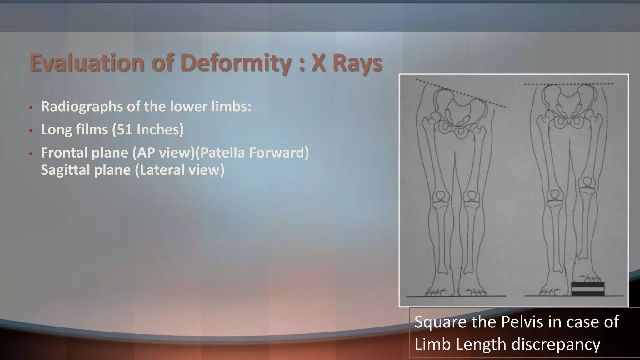 Principles of deformity correction | PPTX