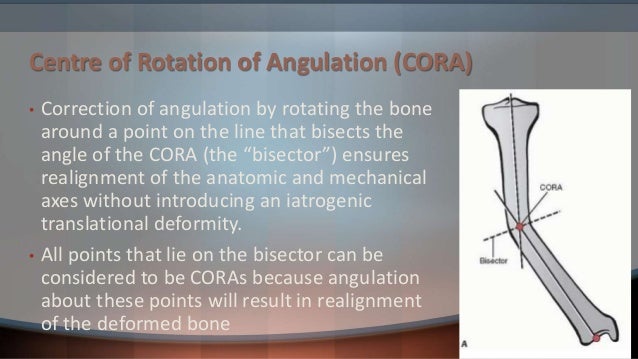 Principles of deformity correction