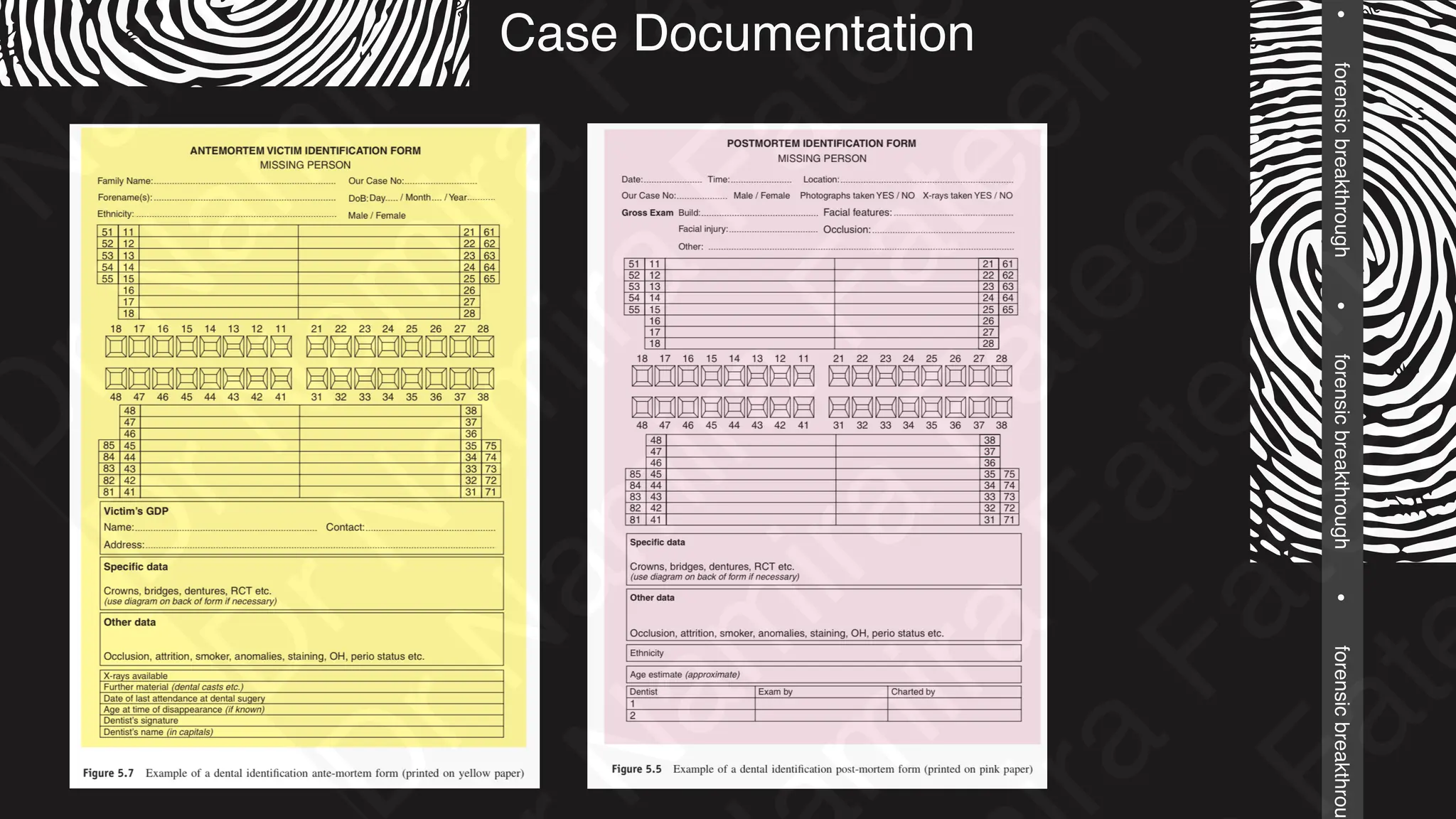 Principles of dental identification- forensic odontology/ Dr Namira ...