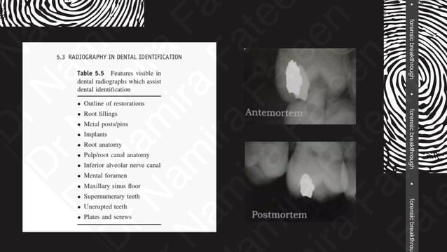 Principles of dental identification- forensic odontology/ Dr Namira ...