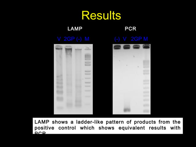 Principles of DNA isolation, PCR and LAMP | PPT | Biological Sciences ...