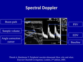Principles of Doppler ultrasound | PPTX