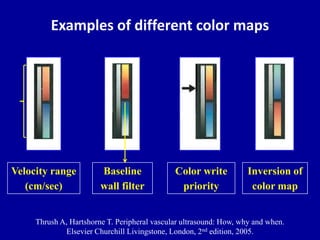 Principles of Doppler ultrasound | PPTX