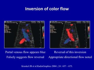 Principles of Doppler ultrasound | PPTX