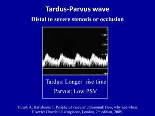 Principles of Doppler ultrasound | PPTX