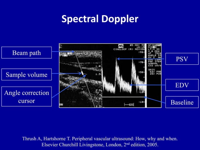 Principles of Doppler ultrasound