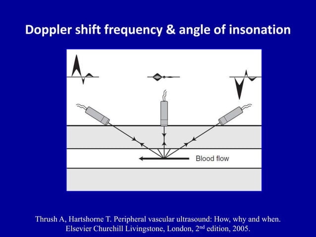 Principles of Doppler ultrasound