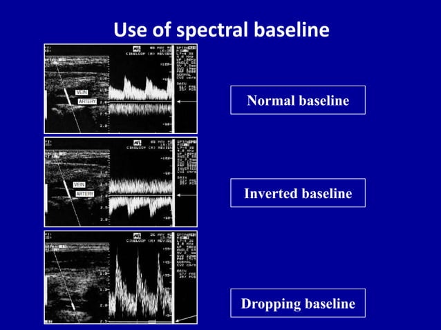 Principles of Doppler ultrasound