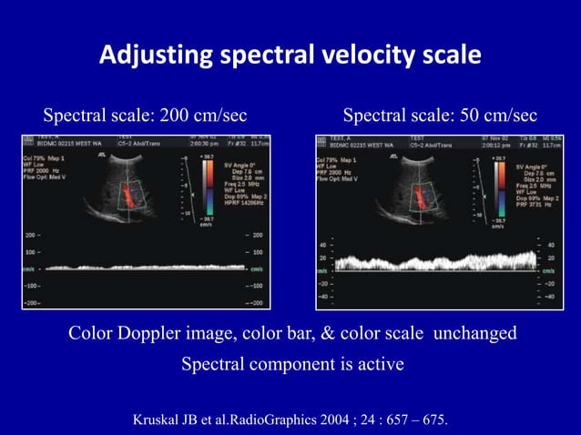 Principles of Doppler ultrasound