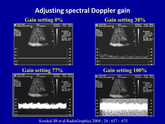 Principles of Doppler ultrasound