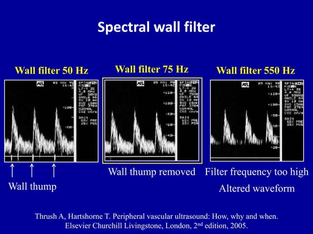 Principles of Doppler ultrasound