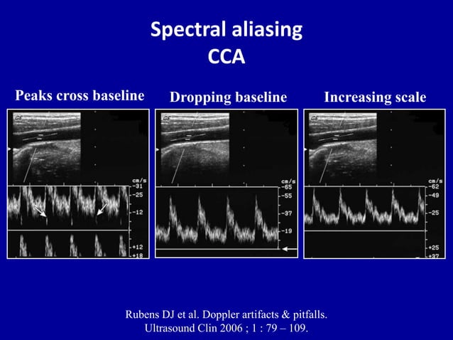Principles of Doppler ultrasound
