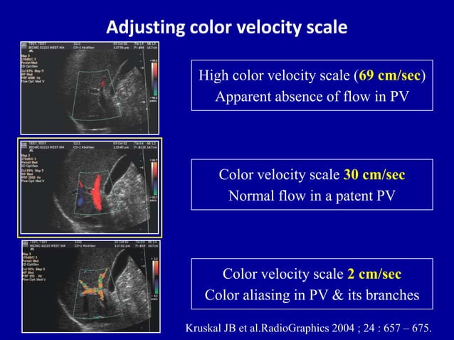 Principles of Doppler ultrasound