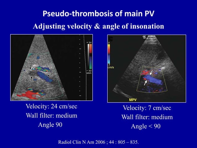 Principles of Doppler ultrasound