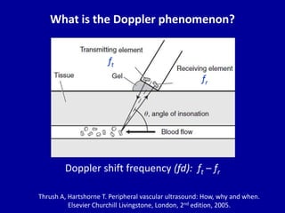 Principles of Doppler ultrasound | PPT