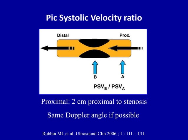 Principles of Doppler ultrasound