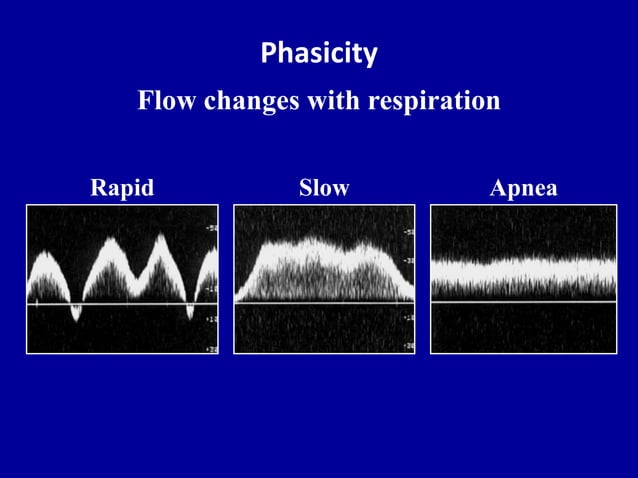 Principles of Doppler ultrasound