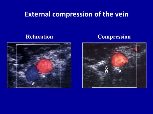 Principles of Doppler ultrasound