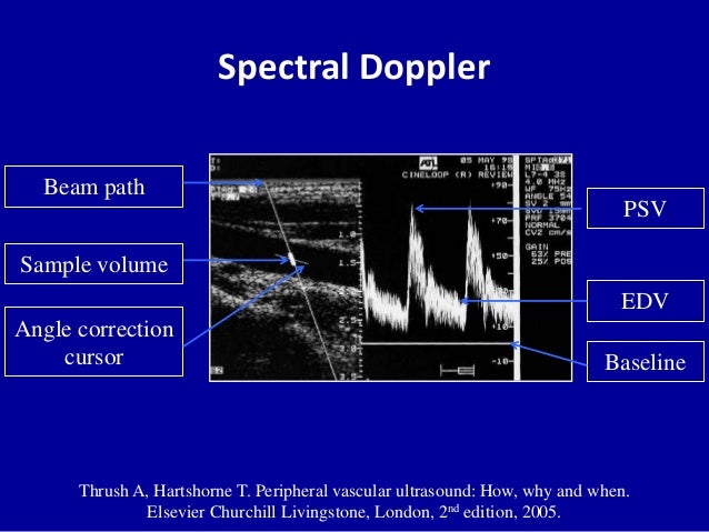 Principles of Doppler ultrasound