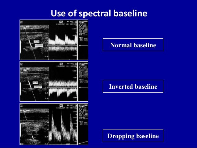 Principles of Doppler ultrasound