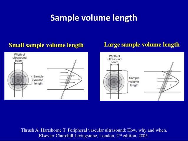 Principles of Doppler ultrasound