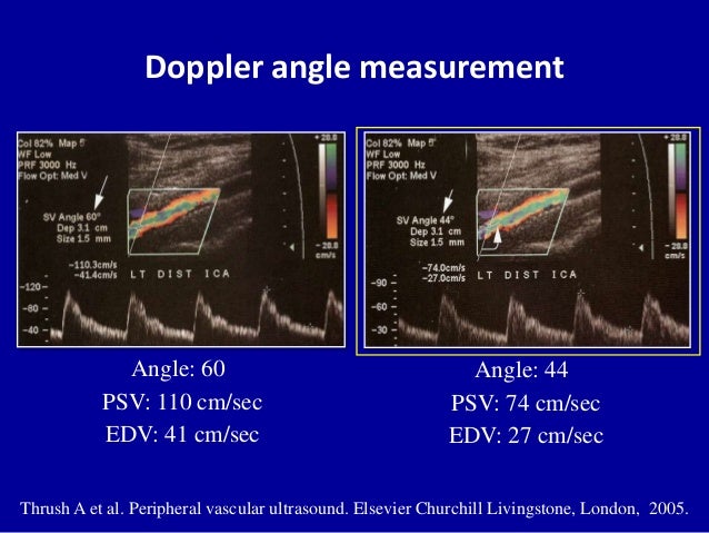 Principles of Doppler ultrasound