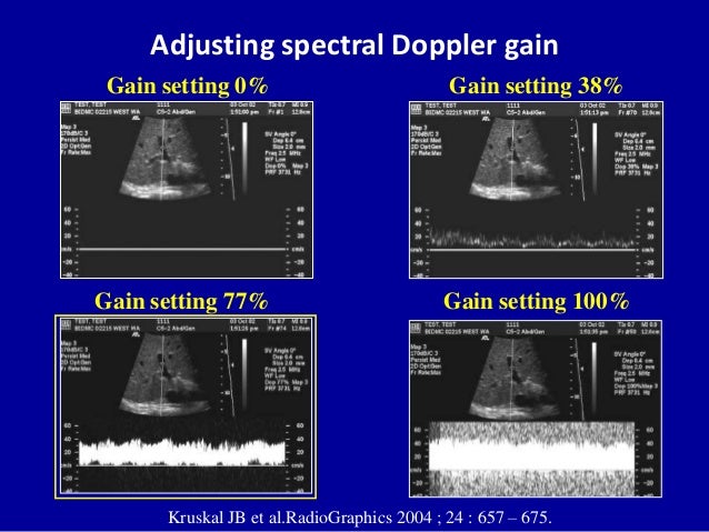 Principles of Doppler ultrasound
