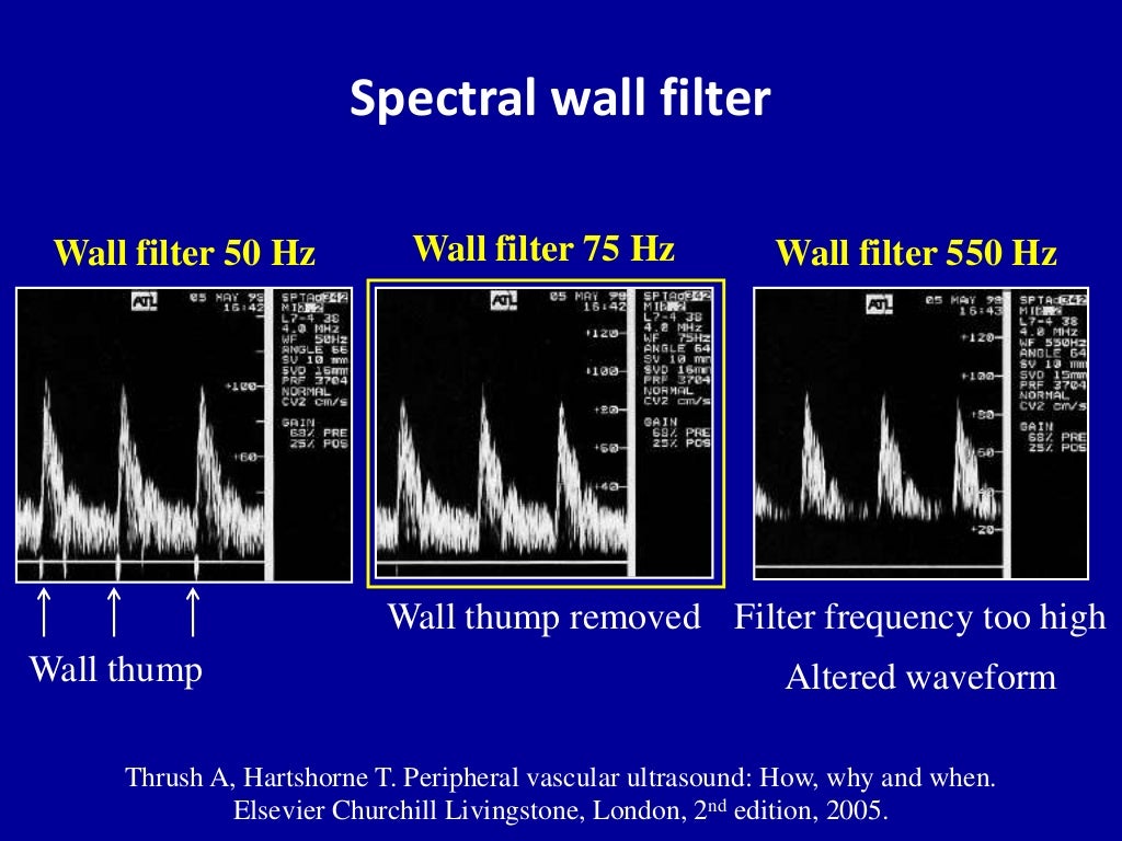 Principles of Doppler ultrasound