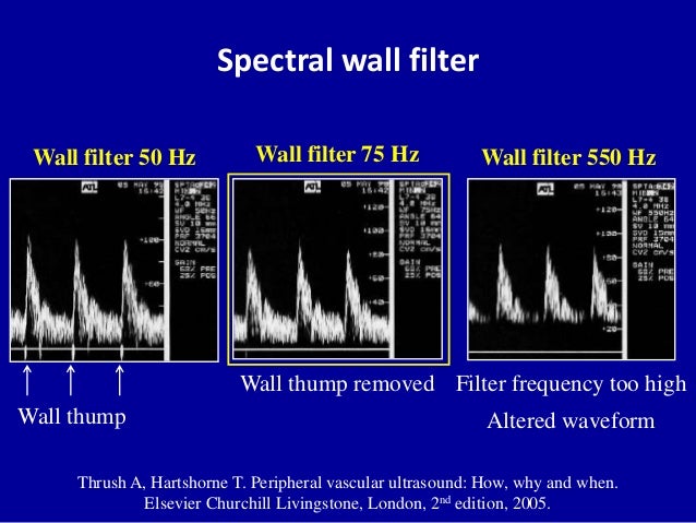 Principles of Doppler ultrasound