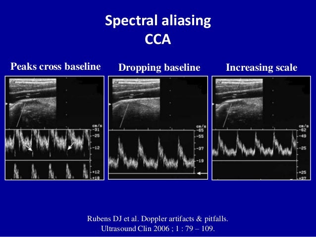 Principles of Doppler ultrasound
