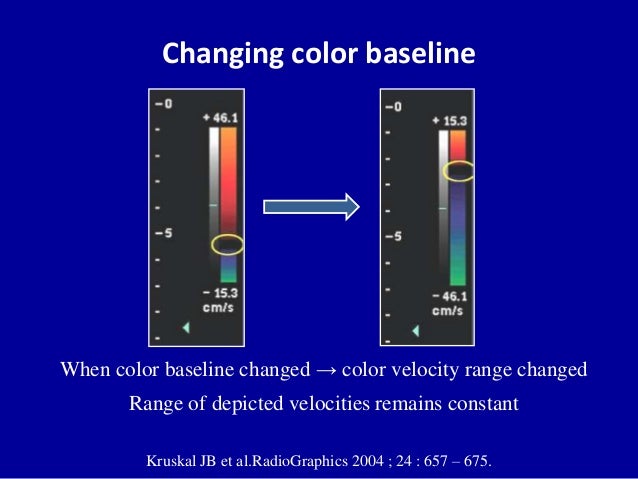 Principles of Doppler ultrasound