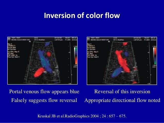 Principles of Doppler ultrasound