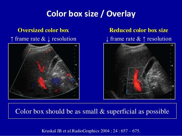 Principles of Doppler ultrasound