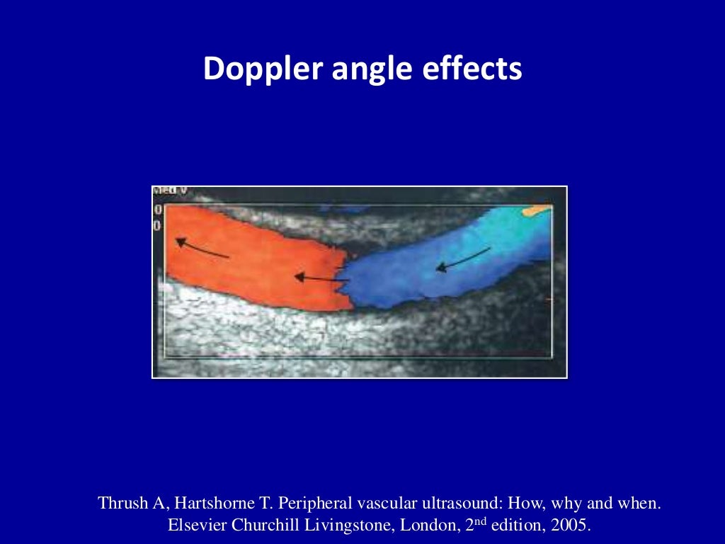 Principles of Doppler ultrasound